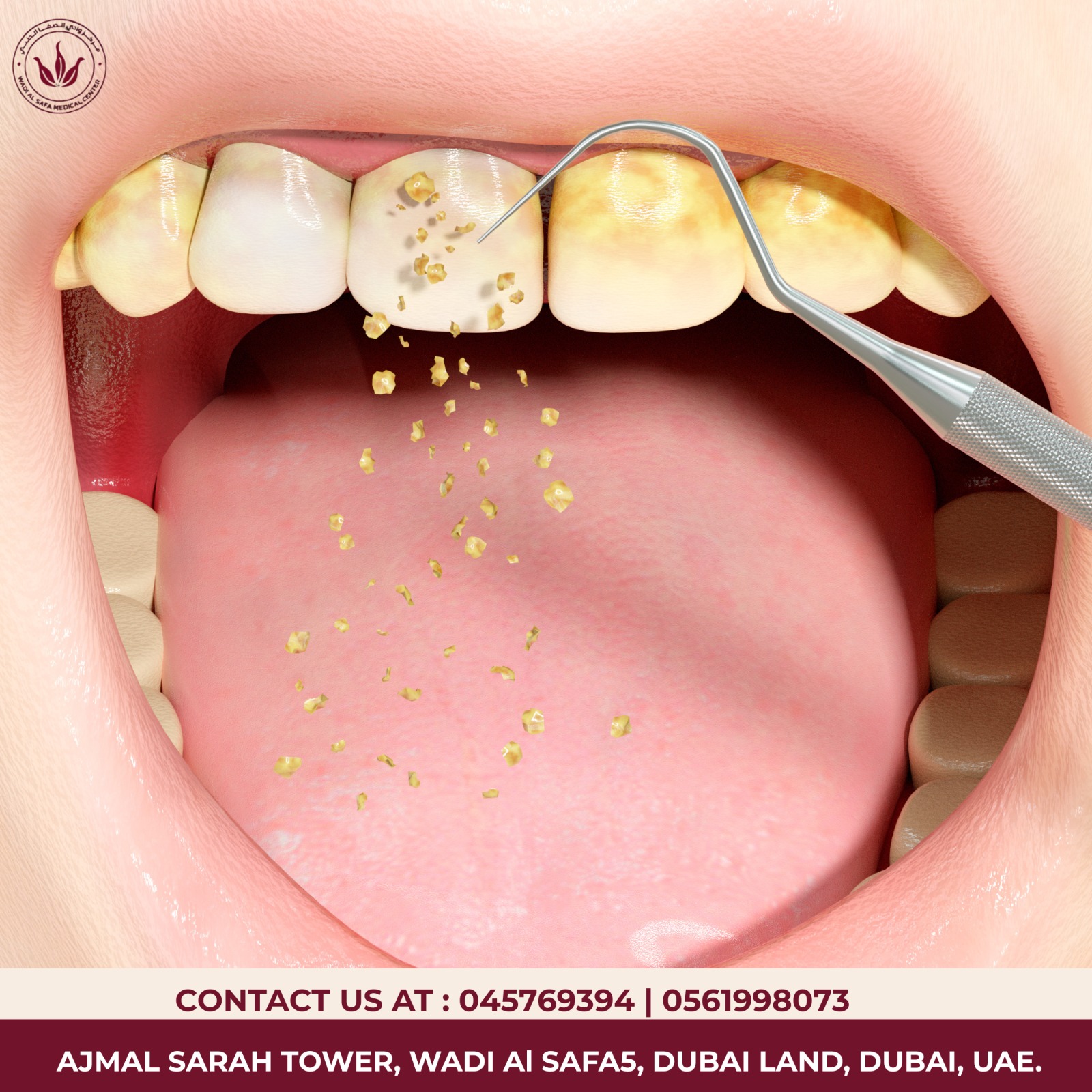 Teeth Cleaning Process & What to Expect At Wadi Al Safa Medical Center ...
